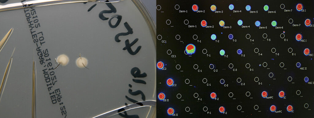 Ein erschütternder Fall - Euroimmun Blog